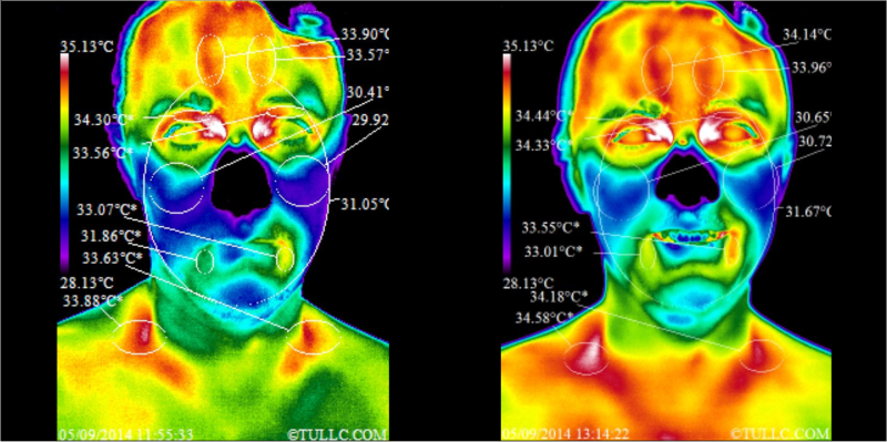 Grounding Improves Facial & Abdominal Circulation - Earthing Institute